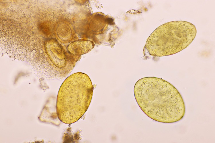 Liver Flukes in Goats: Parasites With a History - Goat Journal